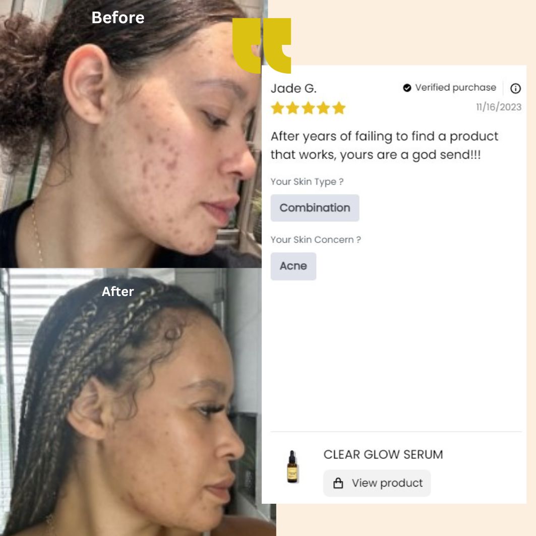 Clear Glow Serum – Gwenivere Skin